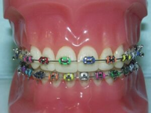 ΟΡΘΟΔΟΝΤΙΚΕΣ ΣΥΣΚΕΥΕΣ – Ortho Health